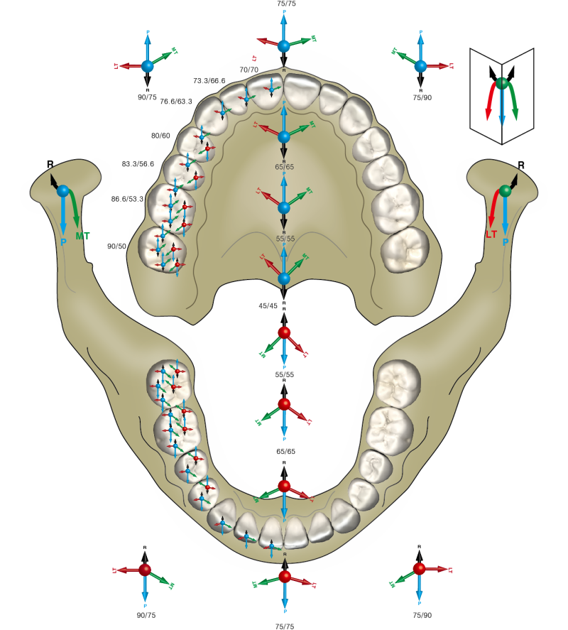 Gothic arch tracing : 네이버 블로그