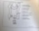 GS) 대장 절제수술 범위 AR, LAR, RHC, LHC : 네이버 블로그