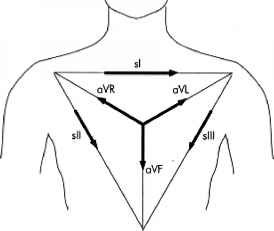 [순환기계8-4] 기본 심전도의 이해(Basic EKG,ECG) 2-1 : 네이버 블로그