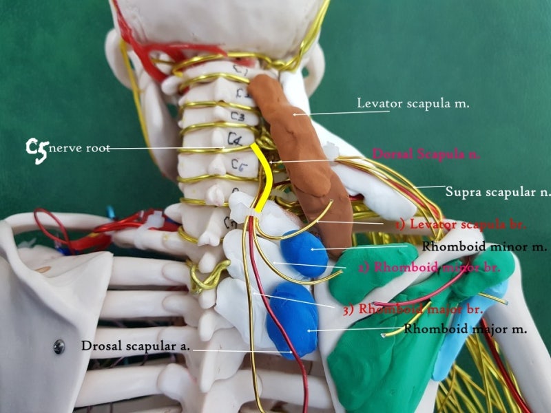 Dorsal scapular nerve(DSN) entrapment : 네이버 블로그