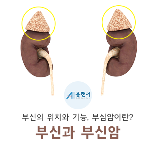 부신피질호르몬 왜 중요한가요 부신 위치와 기능 그리고 부신암 네이버 블로그