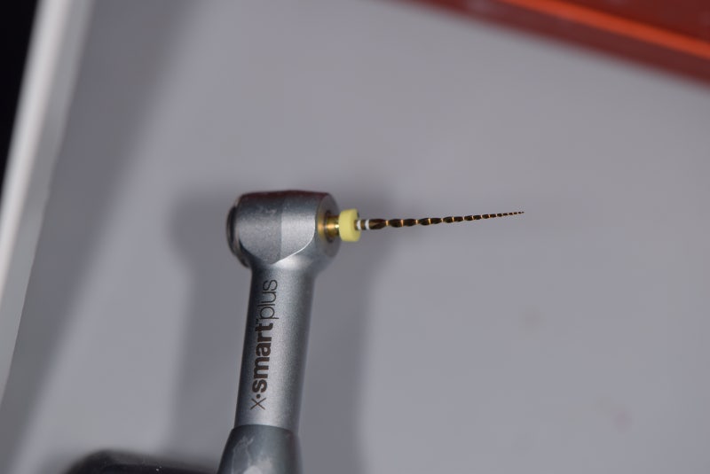 신경치료시 사용되는 기구들 : 네이버 블로그