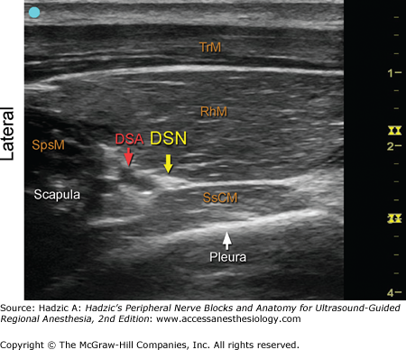 Rhomboid major, minor m. 대 소 능형근 어깨 통증 등담 Dorsal scapular nerve ...