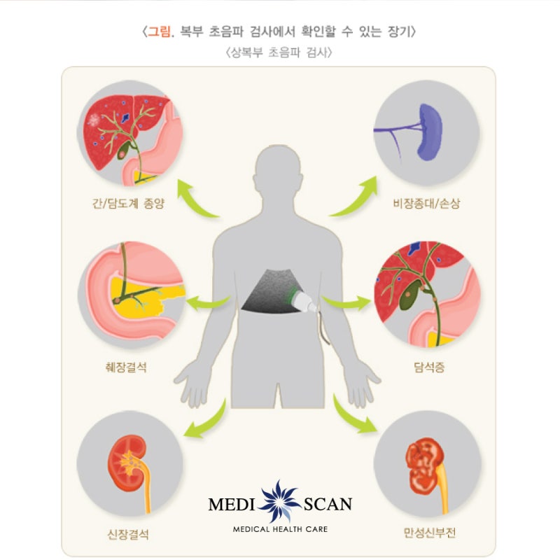 복부초음파는 어떤 증상과 질환에 필요할까요? : 네이버 블로그