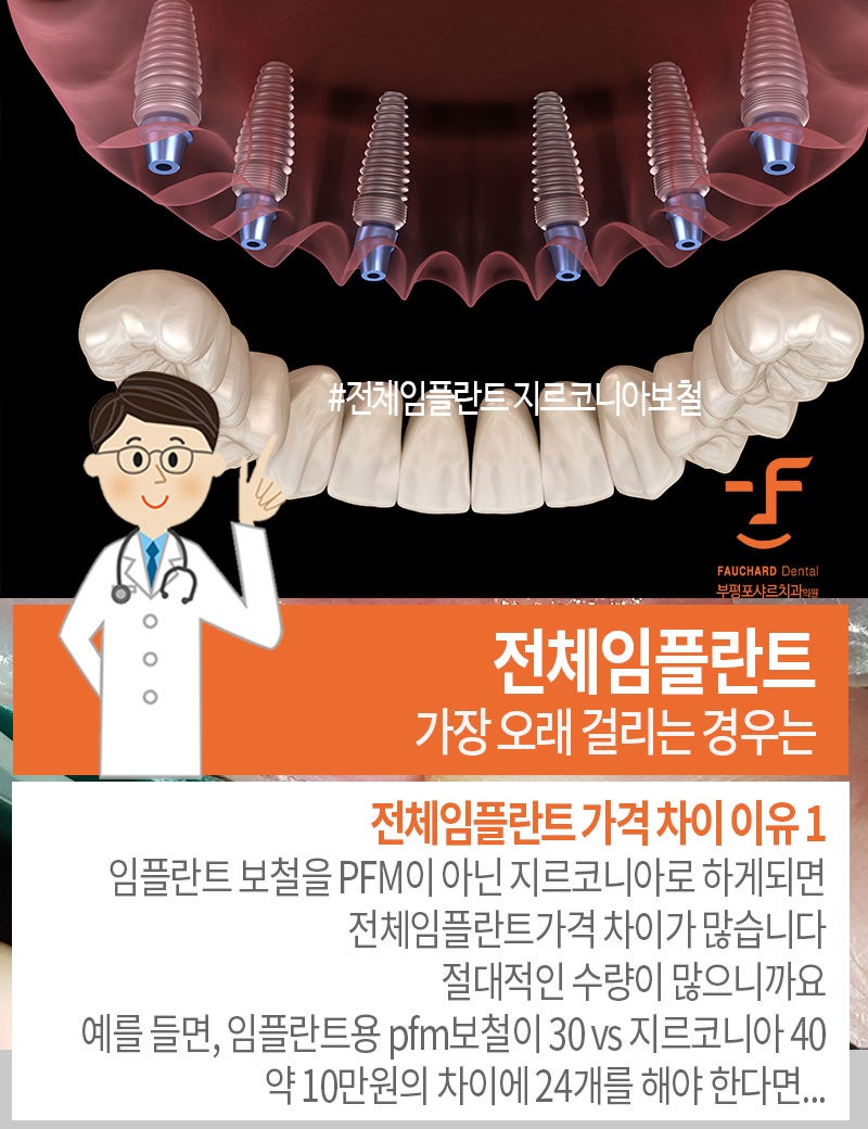 임플란트 가격정보 및 주의사항 전문 이슈칼럼