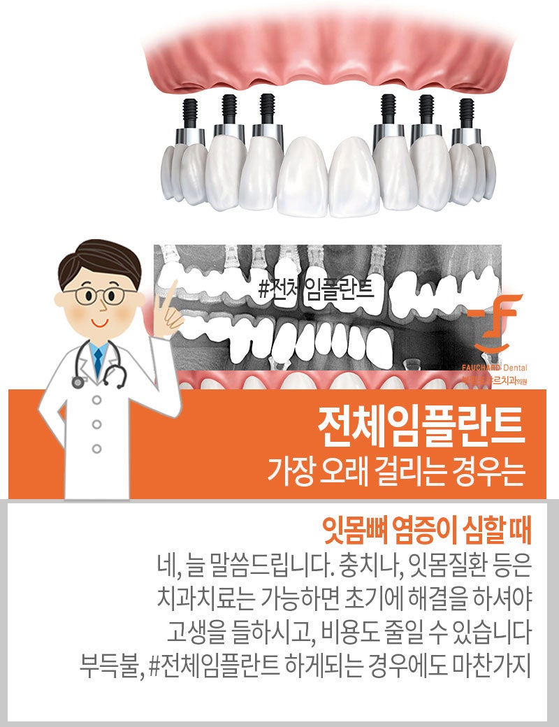 임플란트 가격정보 및 주의사항 전문 이슈칼럼