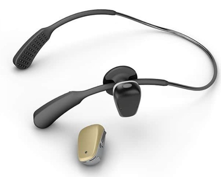 코클리어 미국 캐나타에 바하 사운드아크 출시 : 네이버 블로그