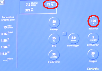 G5 ventilator _ ASV mode ?! : 네이버 블로그