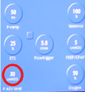 G5 ventilator _ ASV mode ?! : 네이버 블로그