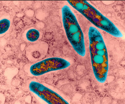 M chimaera 수술부위 감염 : 네이버 블로그