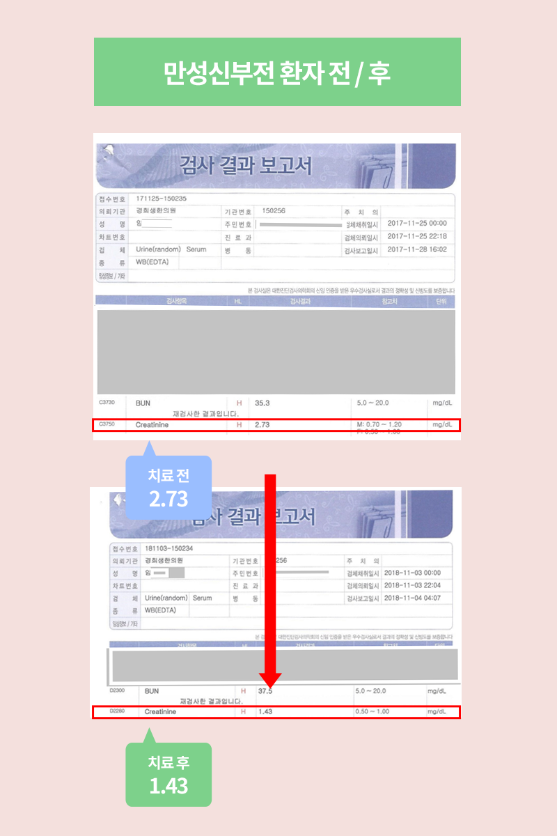 IgA 신증 원인과 치료 그리고 진단 : 네이버 블로그