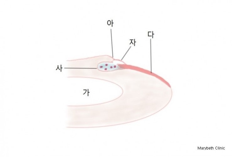 제3장. 손발톱의 발생학 Embryology of the nail : 네이버 블로그