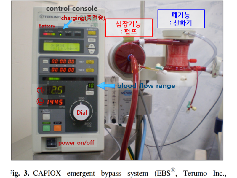 ECMO : 네이버 블로그