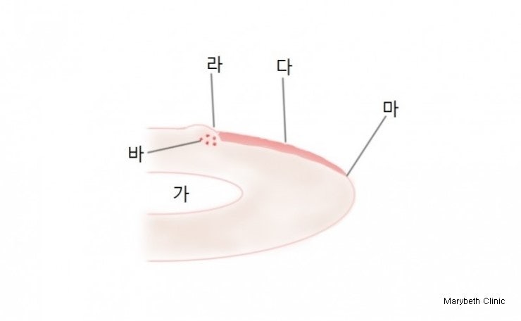 제3장. 손발톱의 발생학 Embryology of the nail : 네이버 블로그