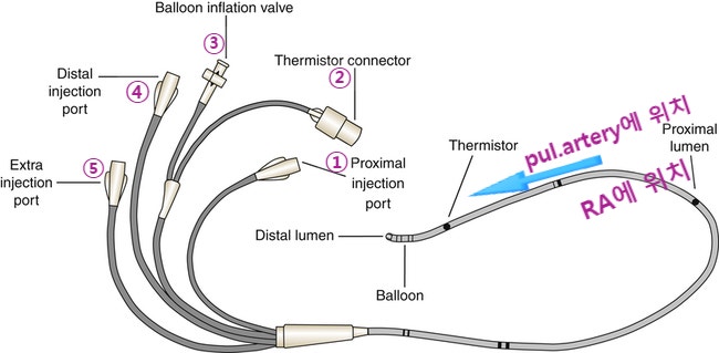 Swan-ganz catheter (pulmonary artery catheter) : 네이버 블로그