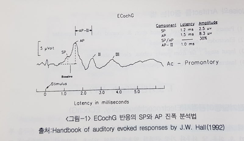 전기달팽이관 검사 ECochG 반응의 SP와 AP 진폭 분석법 : 네이버 블로그