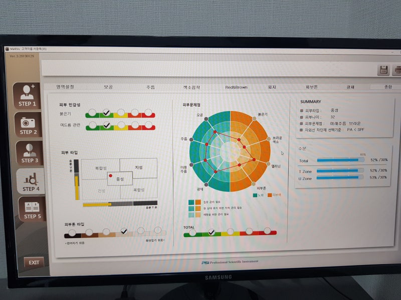 정확한 진단을 위해 노력하는 '더리턴피부과' @1편 마크뷰(Mark VU) 프리미엄 피부진단기 : 네이버 블로그