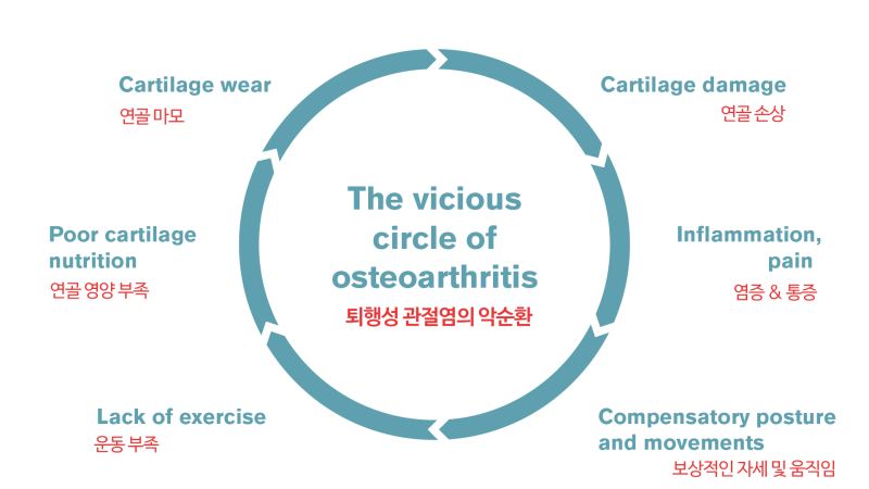 계속 진행되는 퇴행성 무릎관절염골관절염 증상과 자가진단법 네이버 블로그