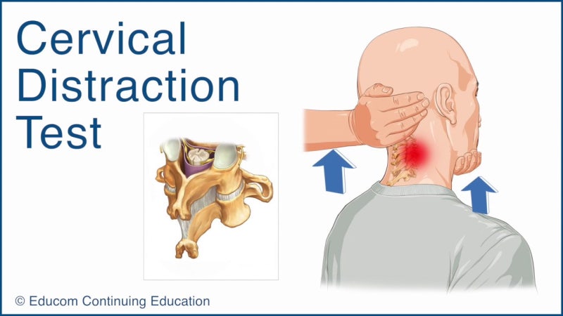 경추 이학적 검사 간단 정리 (Cervical Special test) : 네이버 블로그
