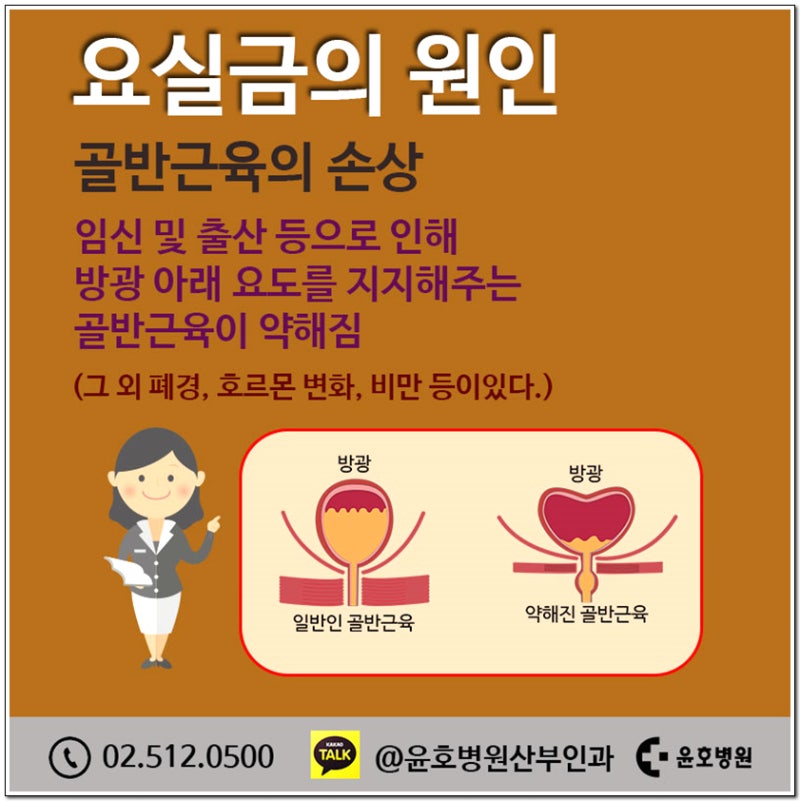 일상생활에 지장이 생기는 과민성 방광의 원인과 증상 치료방법 A7