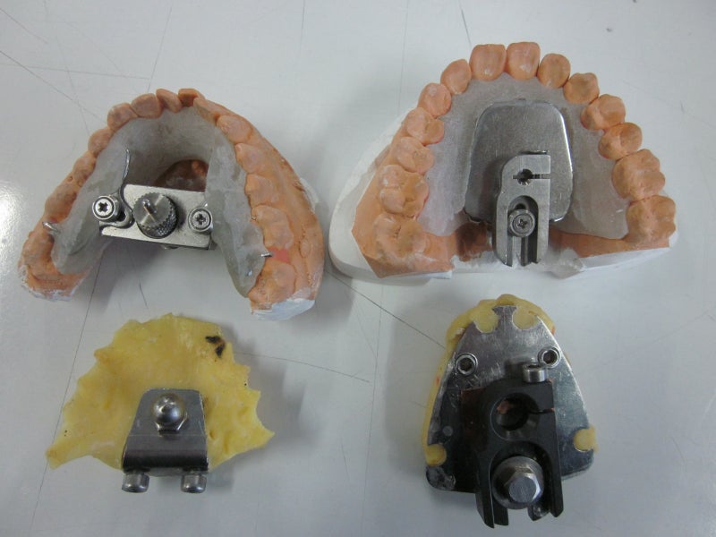 안면(하악)비대칭 교정 고딕아치 CENTROFIX 임상 정복! : 네이버 블로그
