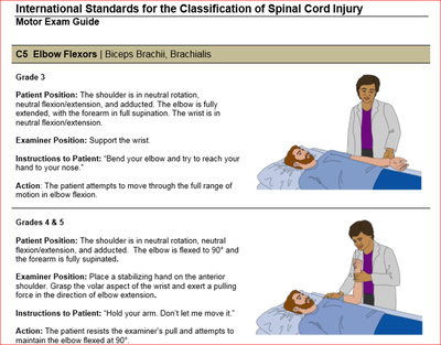 ISNCSCI 쉽게 이해하기(ASIA scale) - #3 Sensory, Motor level & NLI of SCI ...