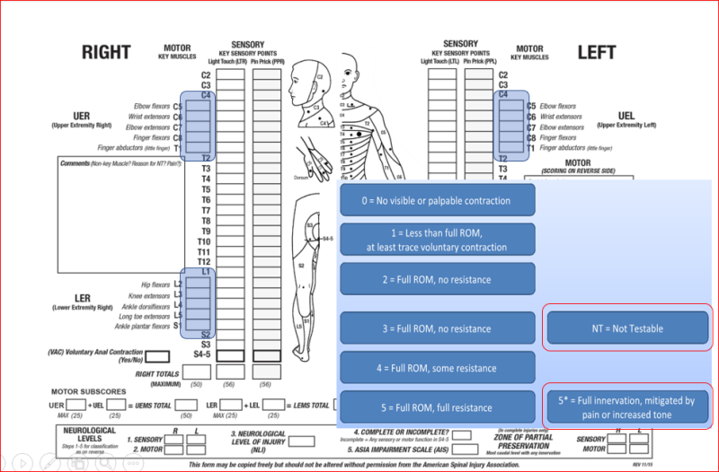ISNCSCI 쉽게 이해하기(ASIA scale) - #3 Sensory, Motor level & NLI of SCI ...