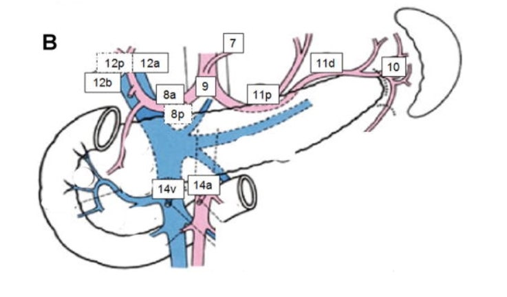 위암 수술에서 D1 dissection과 D2 dissection : 네이버 블로그