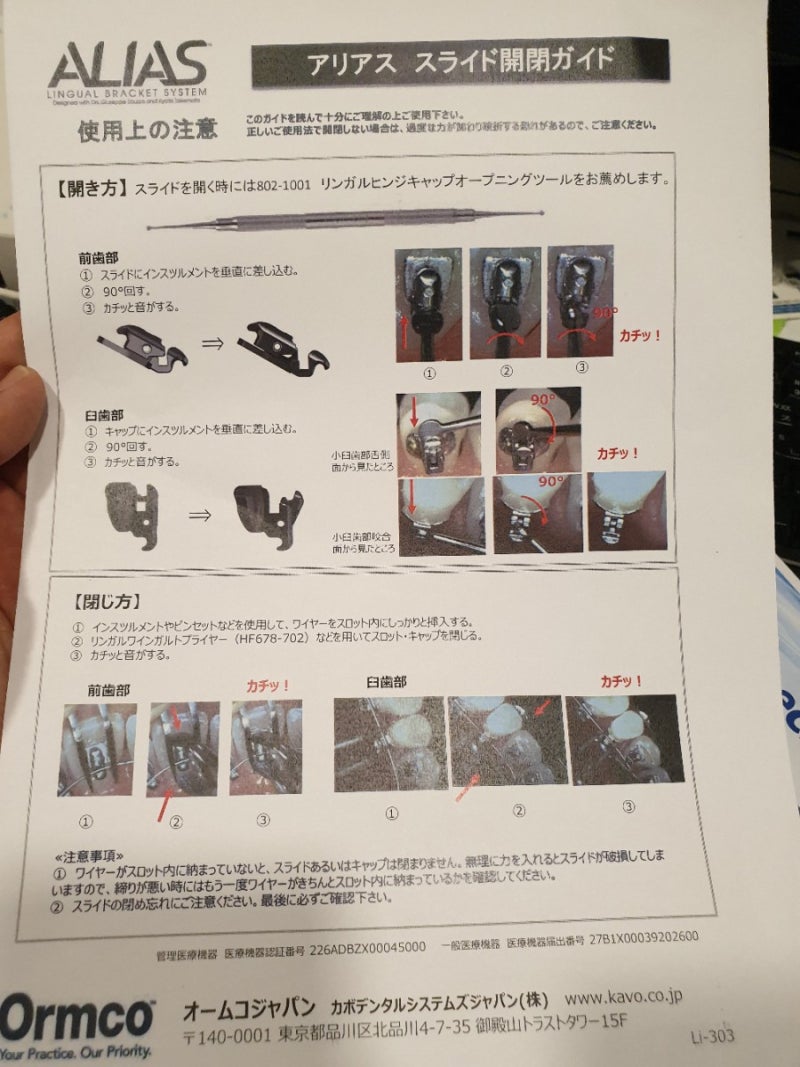 Ormco ALIAS passive lingual bracket 세미나 (앨리어스 설측브라켓) : 네이버 블로그