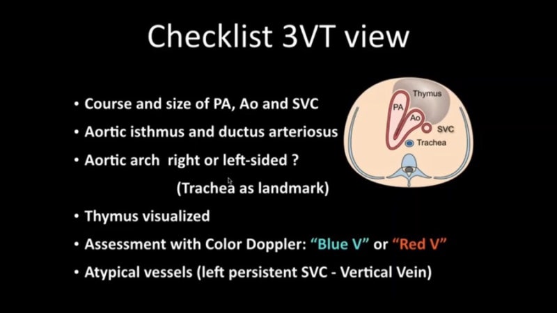 요약]Advanced evaluation of the fetal heart, Dr.Abuhamad, AIUM 강의 정리( 비정상 ...