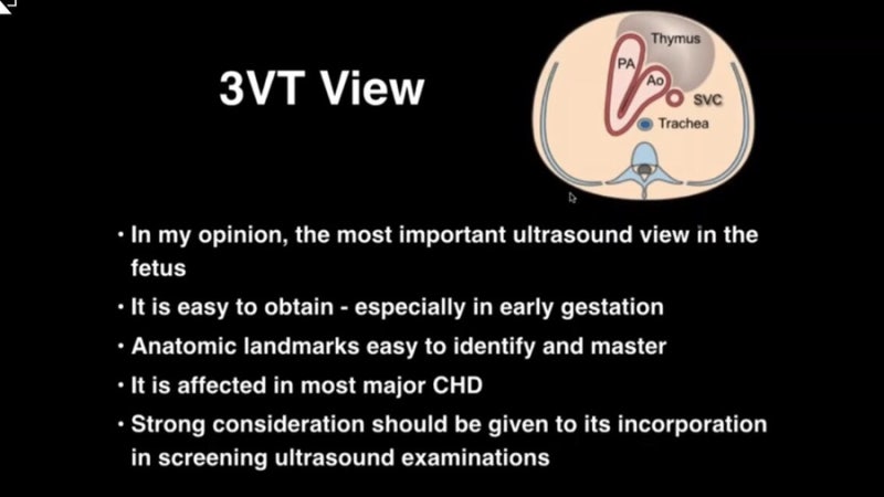 요약]Advanced evaluation of the fetal heart, Dr.Abuhamad, AIUM 강의 정리( 비정상 ...