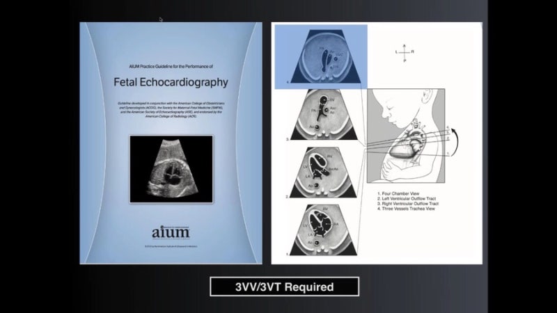 3 vessel trachea view, AIUM 강의 첫 번째( 태아 심장초음파) : 네이버 블로그