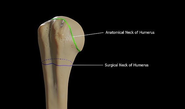 Surgical neck fracture : 네이버 블로그