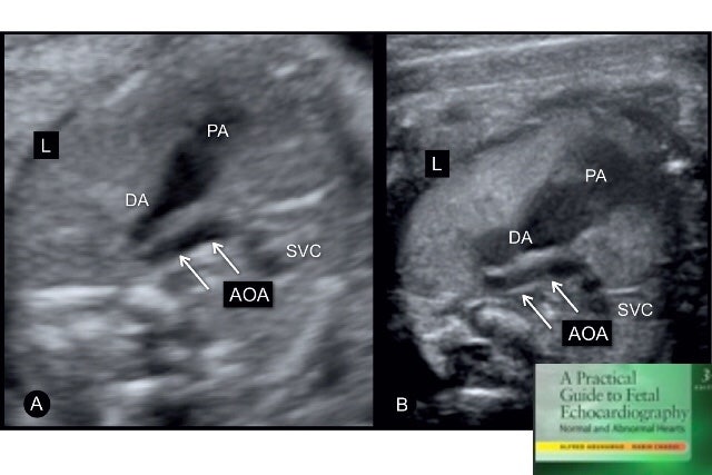 chap23 CoA /IAA 정리 : 네이버 블로그