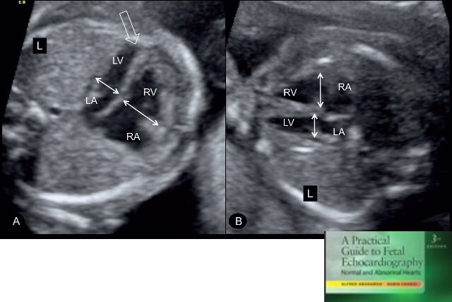 chap23 CoA /IAA 정리 : 네이버 블로그