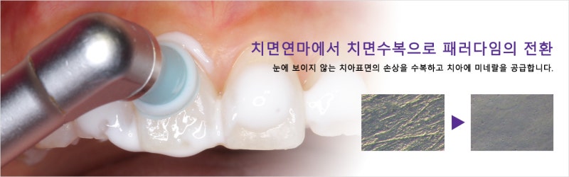 의료용 나노 하이드록시아파타이트(nano medical hydroxyapatite) 이용한 치아재광화촉진제, 아파프로 ...