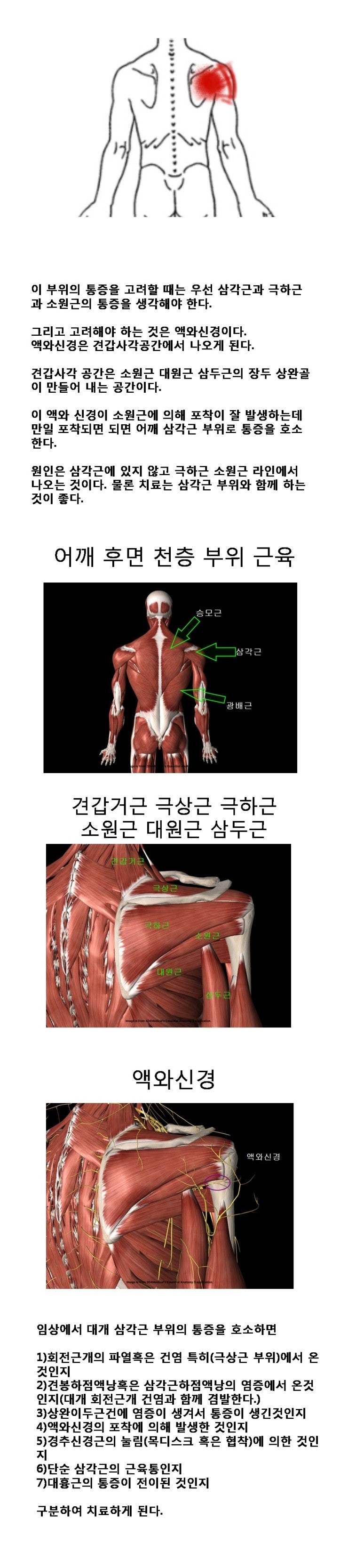 대전 어깨 통증 액와신경 삼각근 부위 통증 어깨가 아파요 삼각근부위가 아파요 견갑사각 공간 위팔부위 통증 액와신경통증 소원근