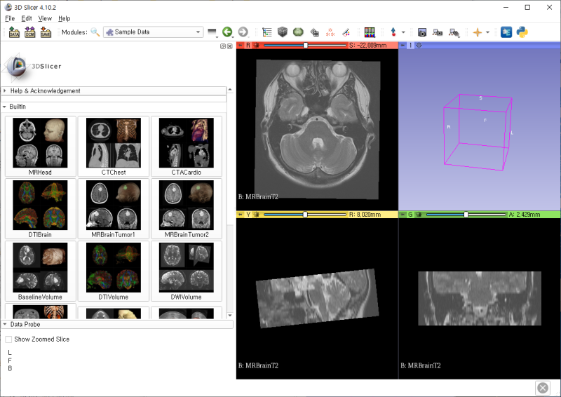 [VTK] 3D Slicer : 네이버 블로그