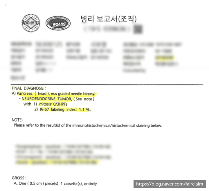 췌장의 양성신생물d137 암 진단비 지급 가능합니다 서울 공정한손해사정 네이버 블로그