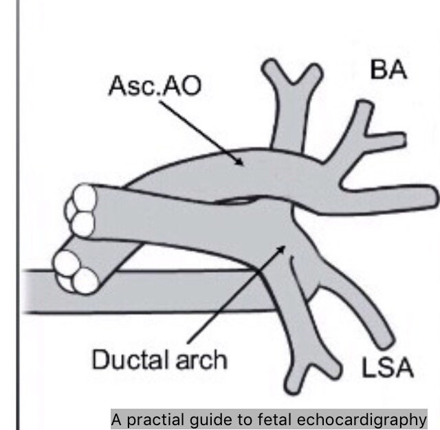 chap23 CoA /IAA 정리 : 네이버 블로그