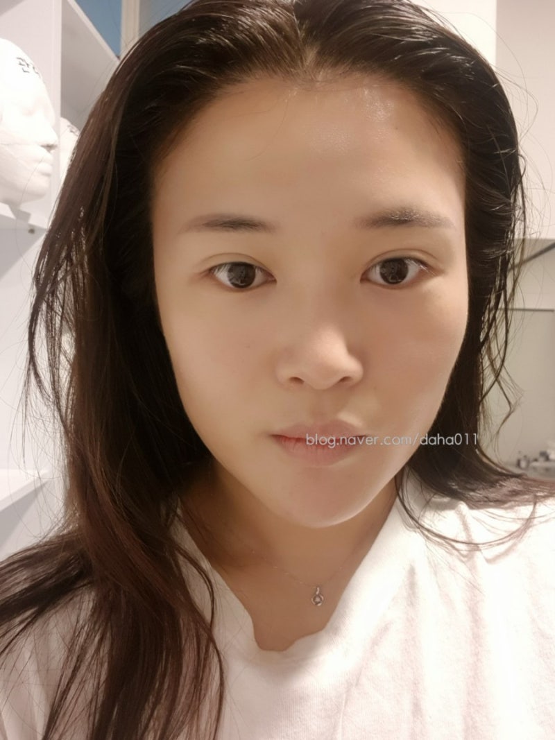 대치역 얼굴윤곽관리 추천 에스테티아 대치1호점 대치동 성형윤곽관리대치역비대칭관리 네이버 블로그