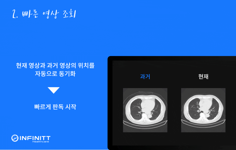 [인피니트헬스케어 솔루션] 영상의학과의 어시스턴트, INFINITT PACS를 소개합니다 #2 진단의 정확도와 효율성을 높이는 ...