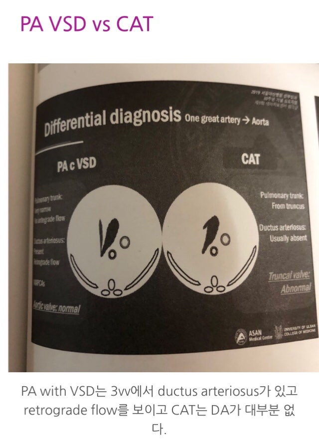Chap 25. TOF ,PA with VSD, Absent PV SD 요약 정리 : 네이버 블로그