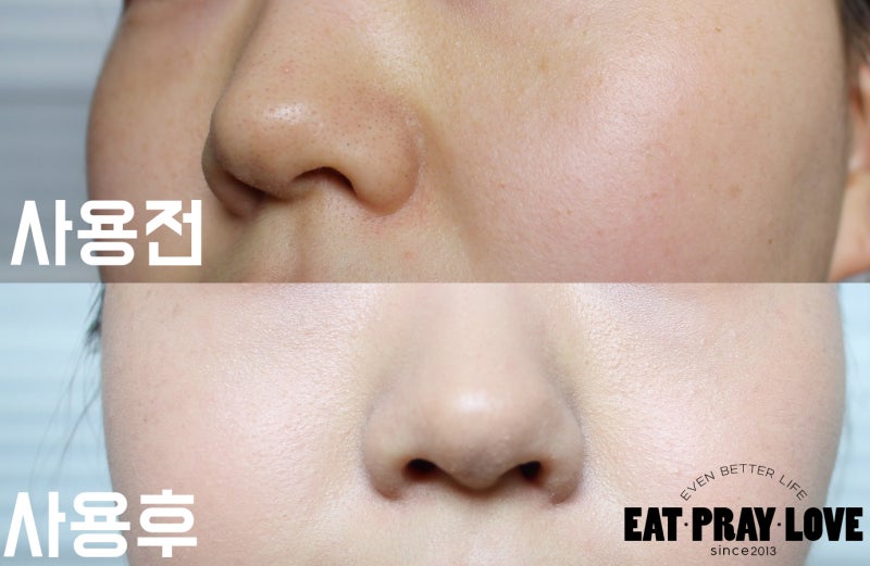 피부과비비크림 Dms 코르테 더모 프로텍션 리바이벌 밤 네이버 블로그
