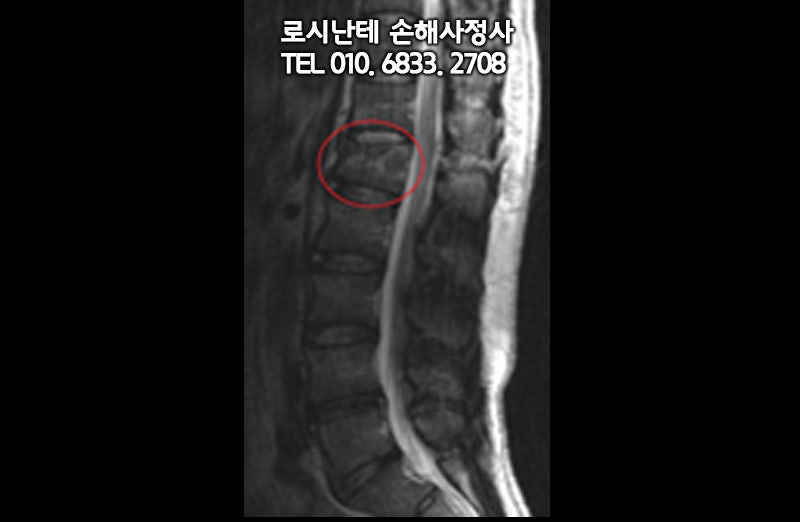 배상책임보험수영장사고 보상 어렵지 않습니다 네이버 블로그