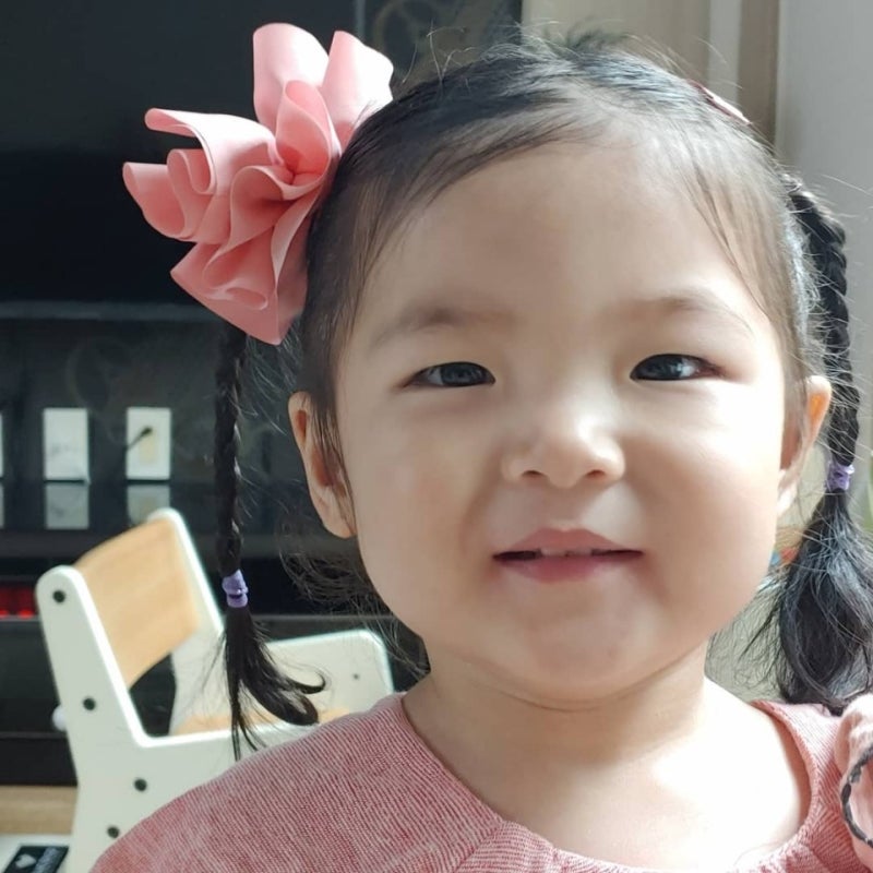 아기 접촉성피부염 증상과 처방 연고약보습제 치료후기 네이버 블로그