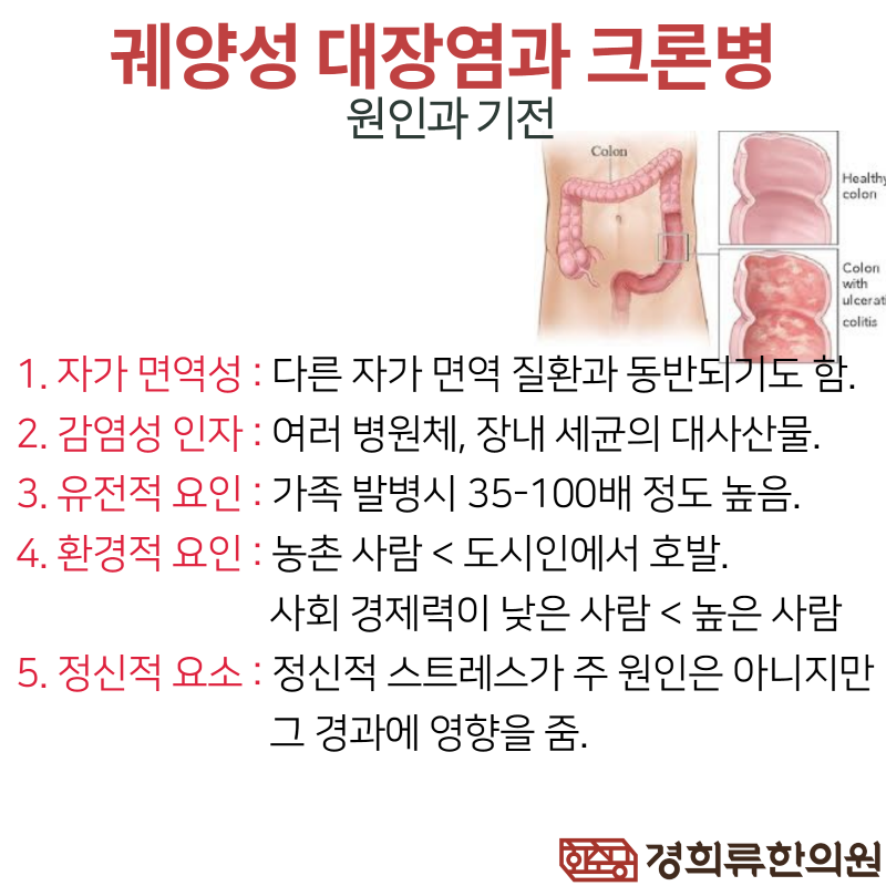 궤양성대장염 명의 용산 궤양성 대장염 한의원용산 크론병 한의원 치료로 면역력을 높이고 장을 안정시키세요 경희류한의원