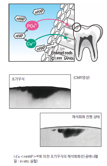 아파프로, APAPRO 나노 하이드록시아파타이트 페이스트 사용법: 프로케어, 셀프케어 : 네이버 블로그