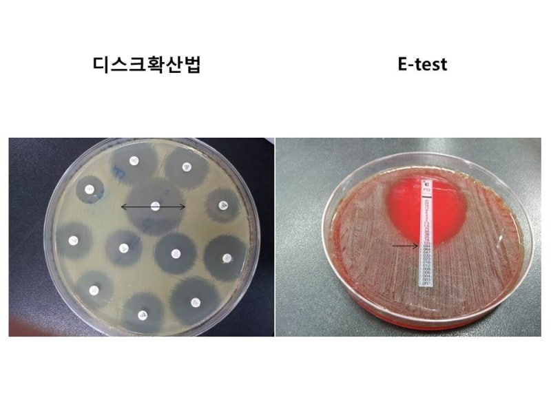 신규간호사가 꼭알아야할 미생물 그람양성그람음성혐기성호성균을 알아야죠 병원에서 자주보는 세균들~ 네이버 블로그