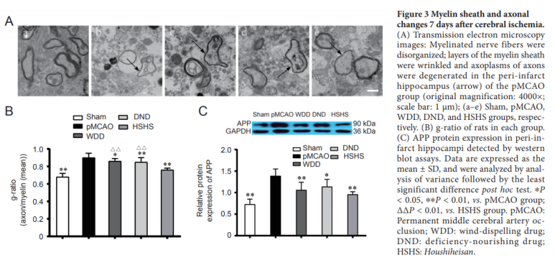 [뇌졸중/한약] 허혈성 뇌손상 후 후씨흑산(侯氏黑散)의 회복 촉진효과: Nogo-A/RhoA/Rock2 및 Netrin-1 ...